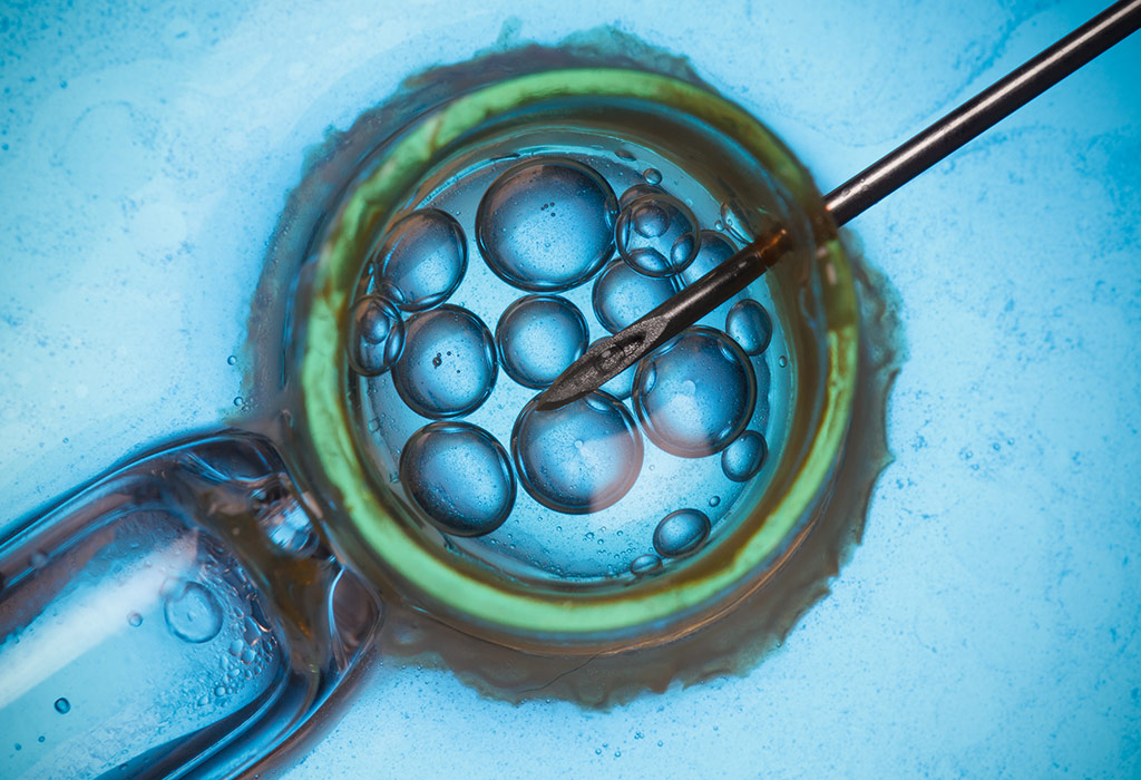 In Vitro Fertilization (IVF) for Infertility Treatment - Gahlaut Health ...