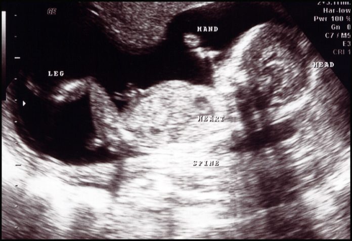 17 Weeks Pregnant: Symptoms, Baby Size, Body Changes & more
