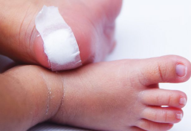 Once a bilirubin test is carried out, the doctor will examine the levels.