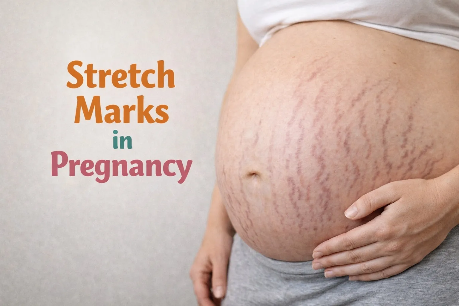 Stretch Marks In Pregnancy- Reasons, Home Remedies & Prevention