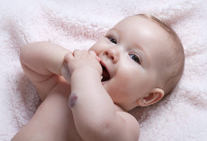 Birthmarks in Babies - Types, Causes & Treatment