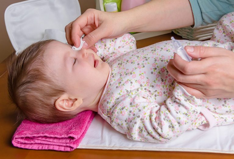 Pink Eyes (Conjunctivitis) in Babies and Kids