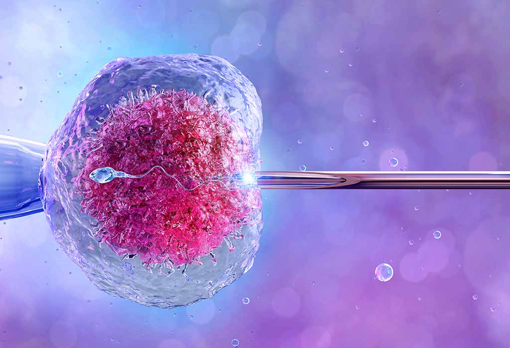 Zygote Intrafallopian Transfer: Procedure, Success Rate & More