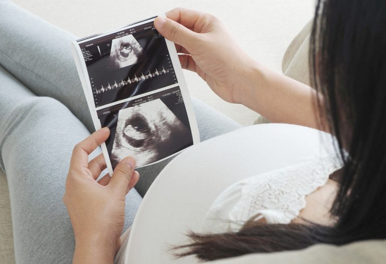 True Umbilical Cord Knot - Signs, Causes, Risks Factors & Treatment