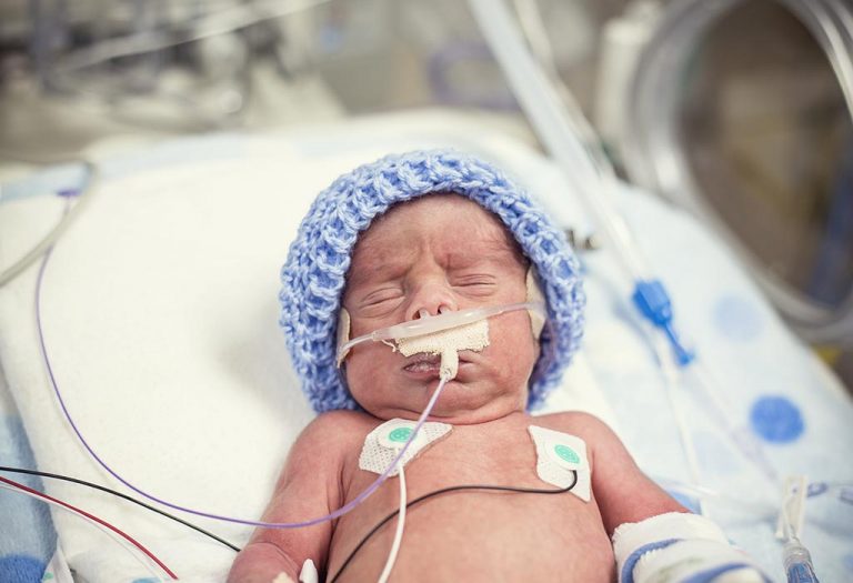 17 Most Common Premature Baby Health Problems