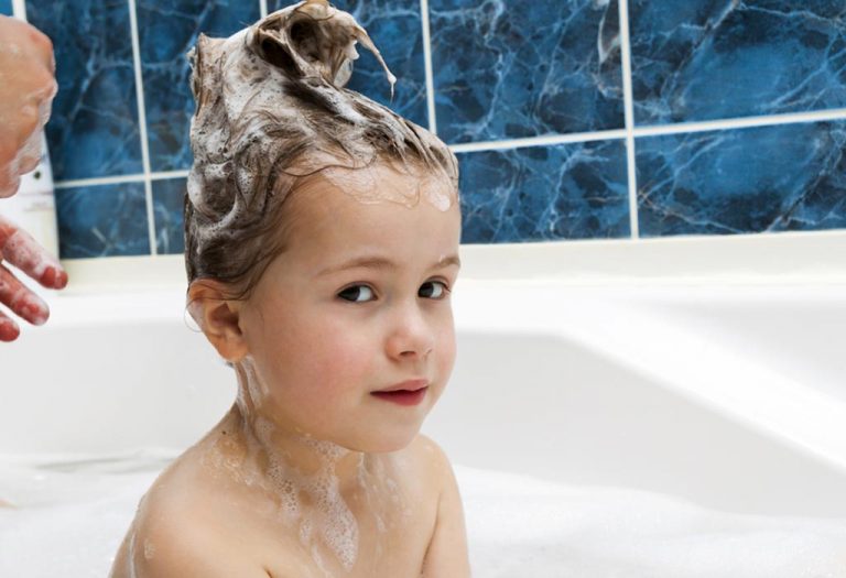Home Remedies for Dandruff in Children