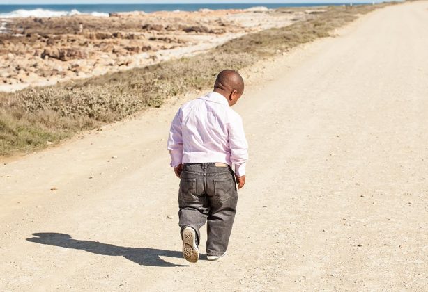 Dwarfism in Kids - Types, Causes, Symptoms and Treatment