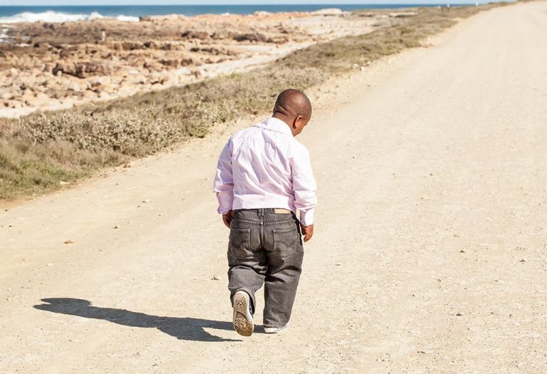 Dwarfism in Kids - Types, Causes, Symptoms and Treatment