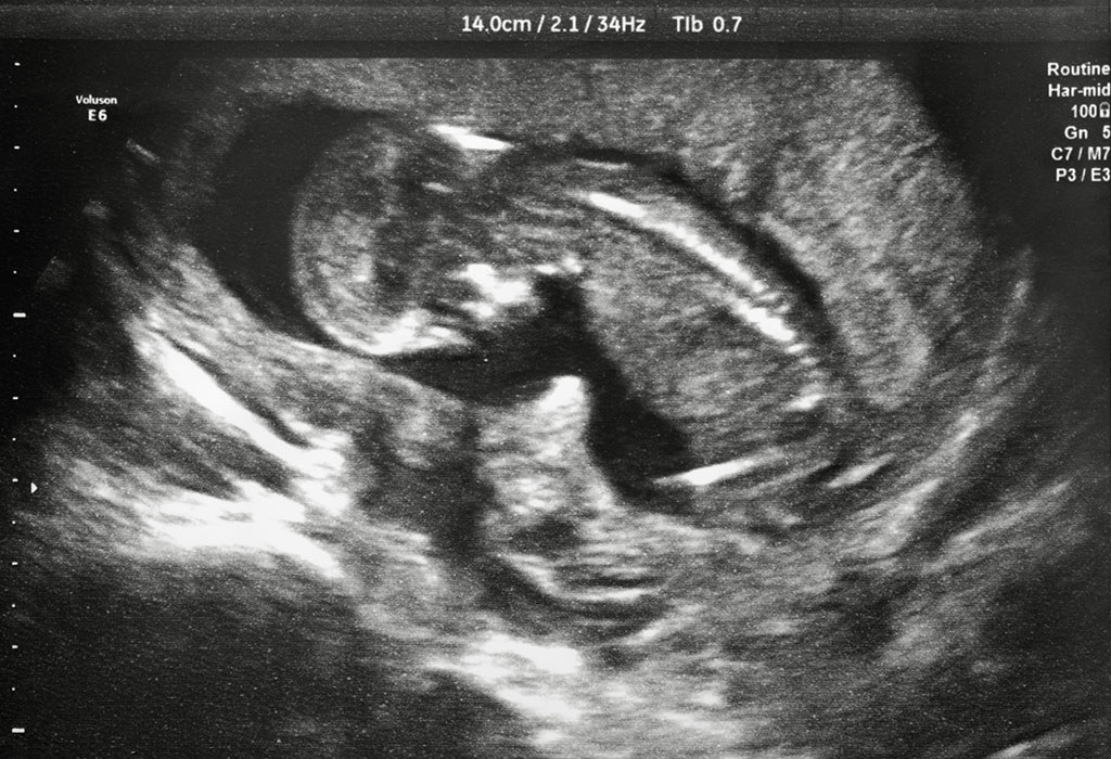 Reading The Contraction Stress Test Results