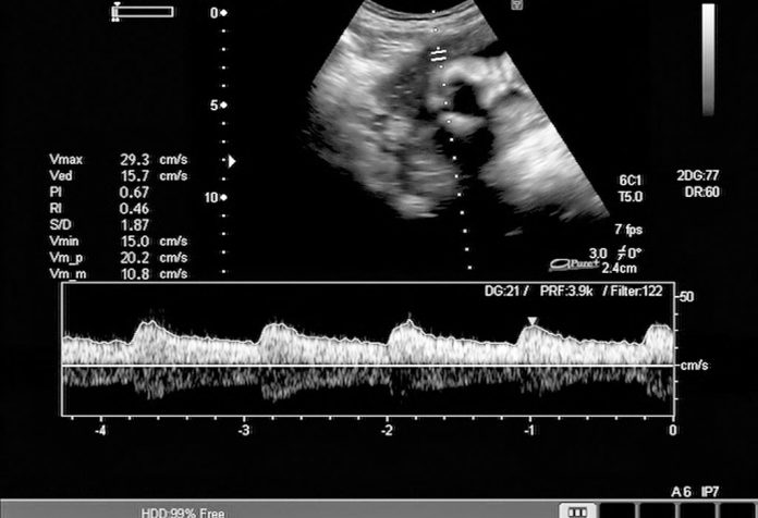 How is Viable or Nonviable Pregnancy Determined?