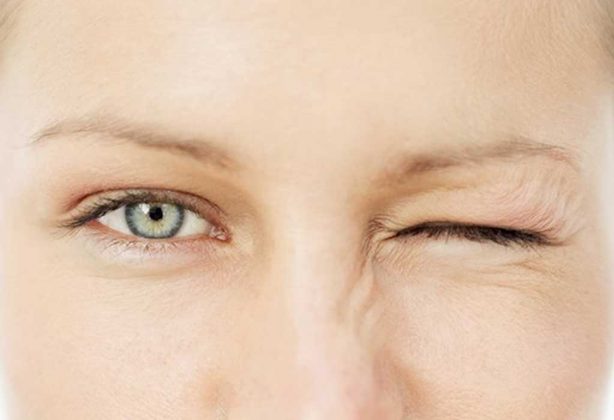 Eye Twitching During Pregnancy Causes Signs And Remedies