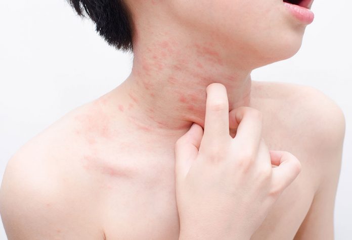 Excessive Sweating (Hyperhidrosis) In Children: Causes, Signs & Treatment