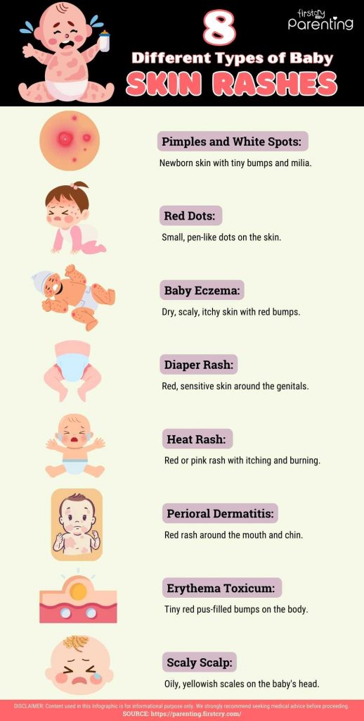 Baby Skin Rashes & Conditions - Types & Treatment