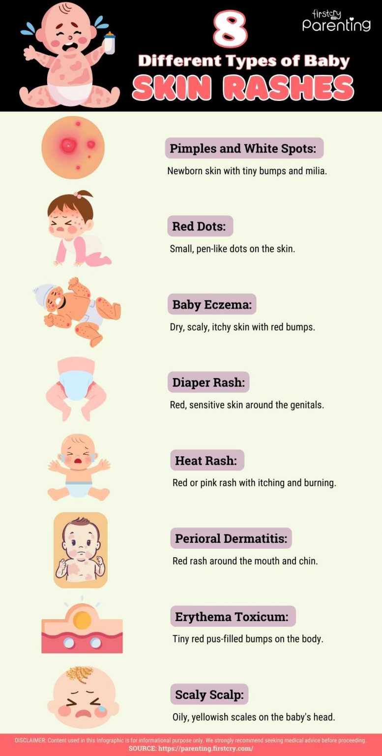 Baby Skin Rashes & Conditions - Types & Treatment