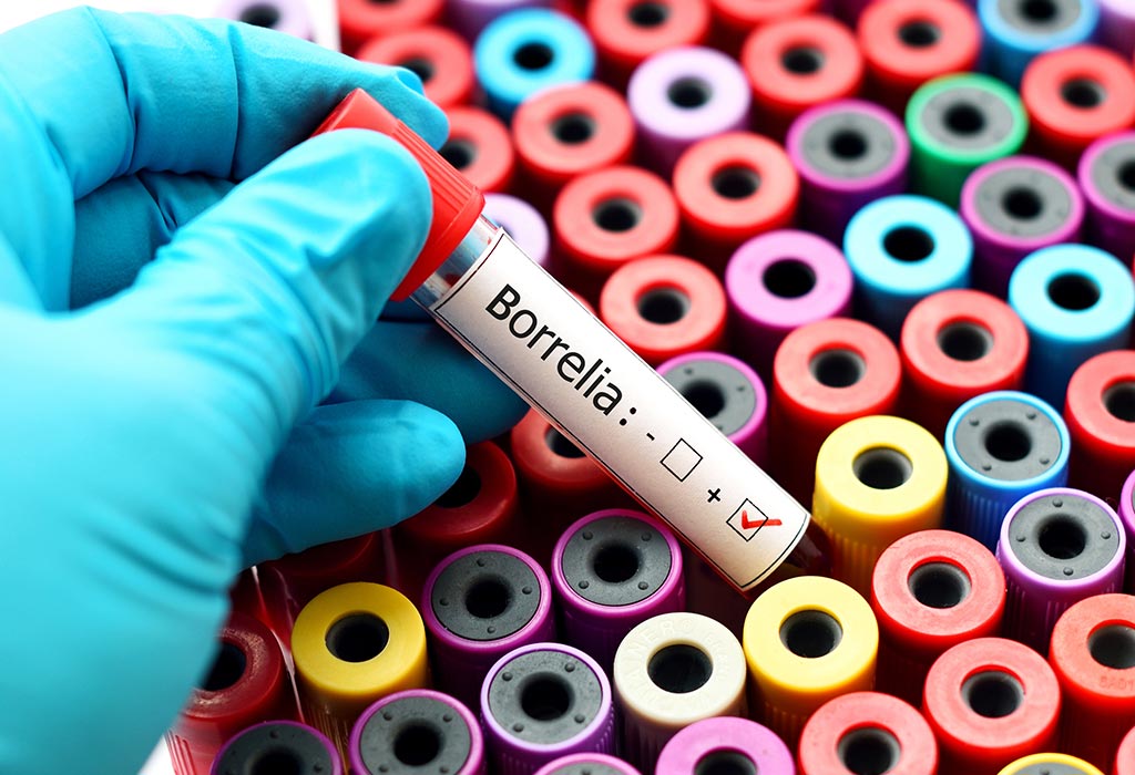 Recurrent Fever in Children - Causes & Tips for Parents