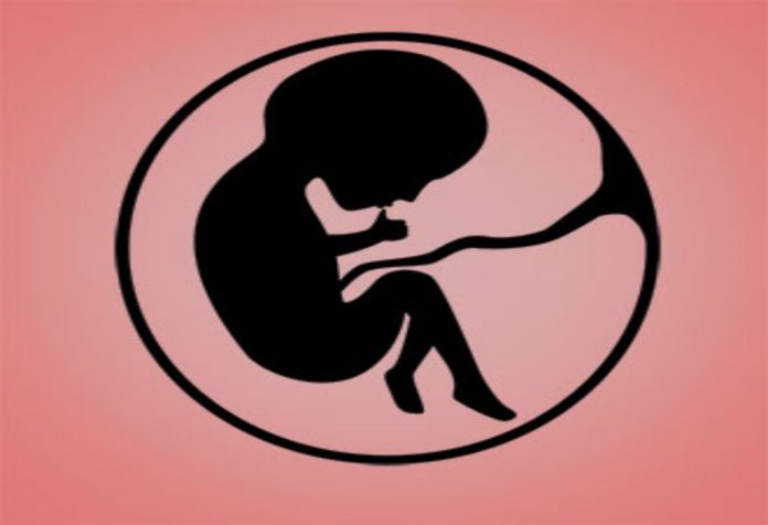 Newborn Belly Button Infection (Omphalitis) - Treatment and Prevention