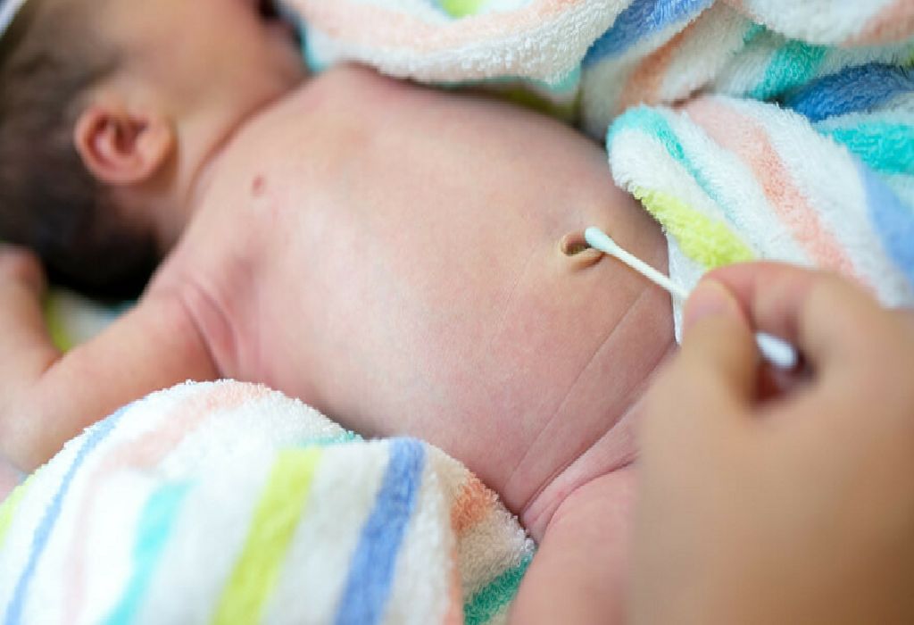 Newborn Belly Button Infection (Omphalitis) - Treatment and Prevention