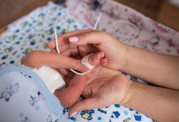 Micro Premature Baby: Causes, Survival Rate & Health Concerns