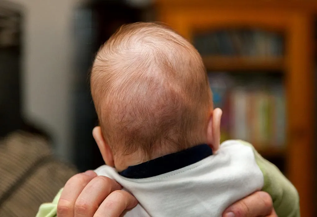 Infant Head Shape: What's Normal and What's Not?