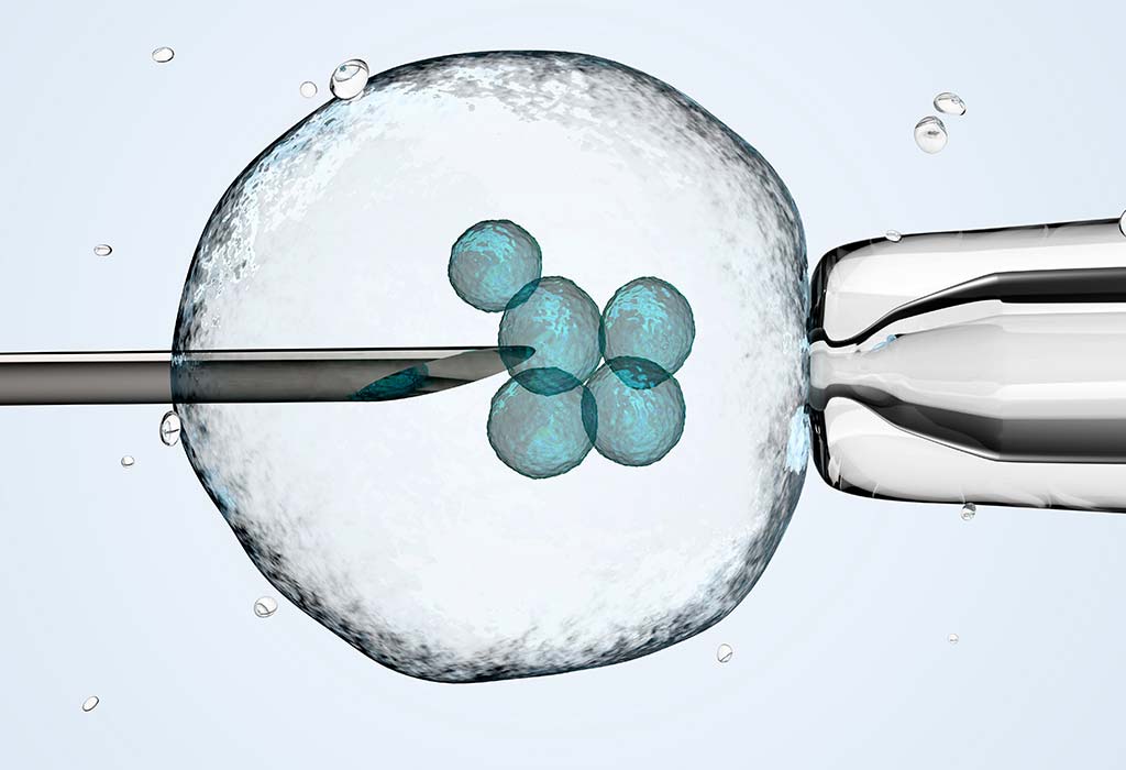 Assisted Hatching: Methods, Procedure, Success Rate & Cost