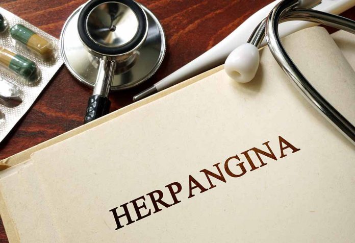 Herpangina in Kids: Reasons, Signs, Treatment & Prevention