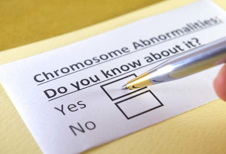 Cyclopia in Babies - Reasons, Signs, Diagnosis & Risk Factors