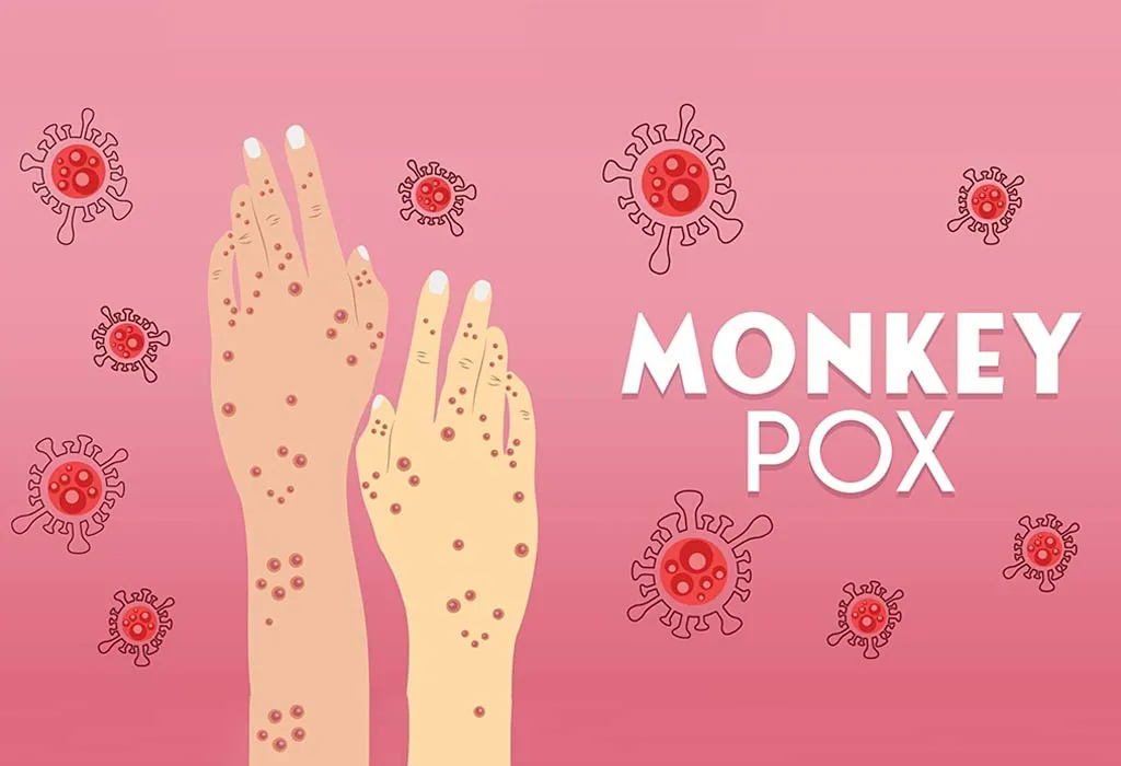 Mpox (Monkeypox) Outbreak - Are Children and Pregnant Women at Risk