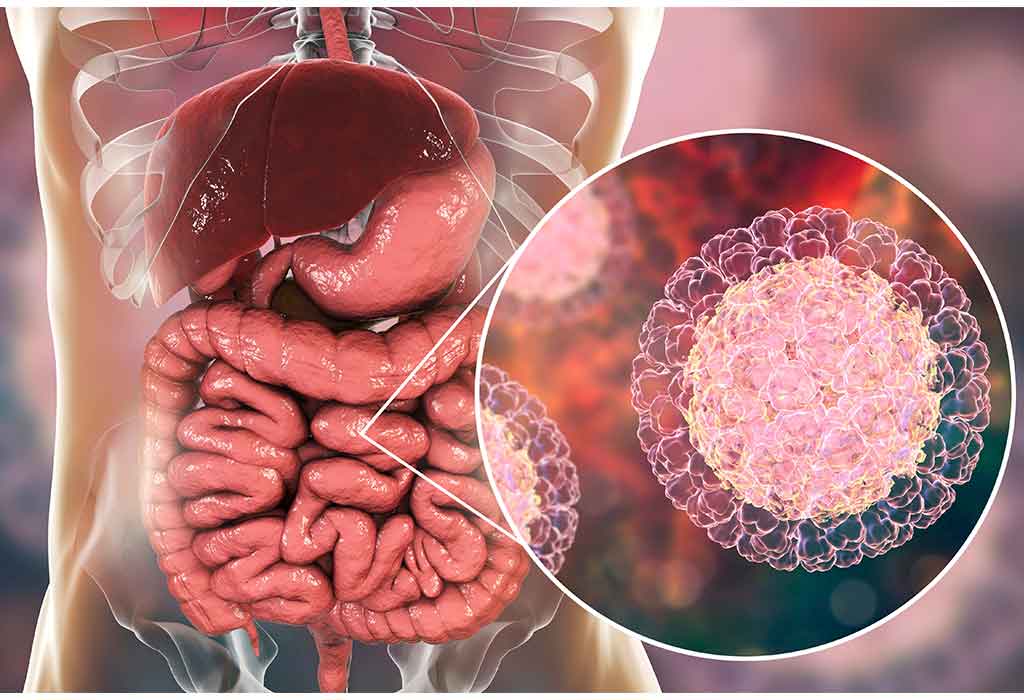 Rotavirus (RV) Vaccine - Benefits, Schedule and Side Effects